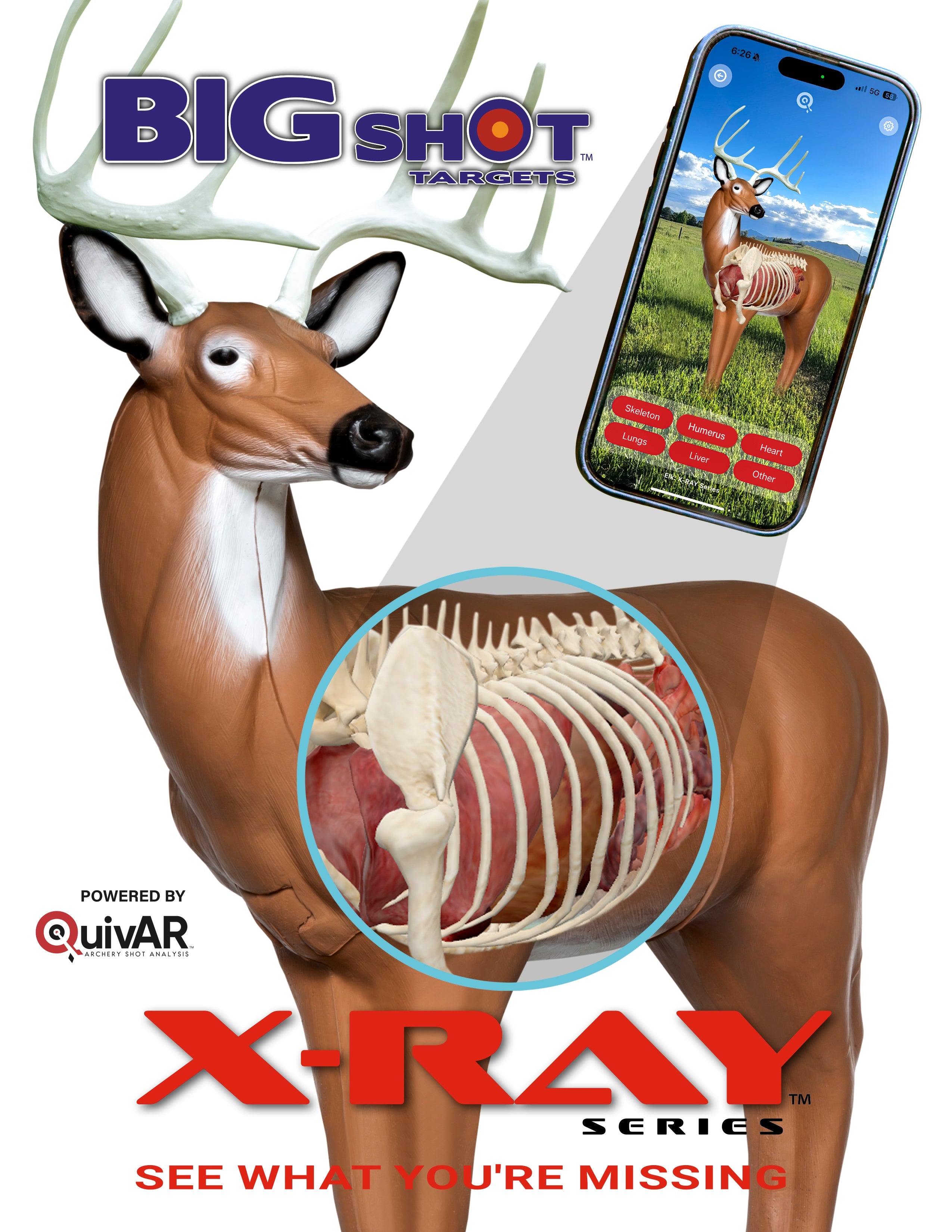 X-Ray Series Big Buck – Vantage Point Archery